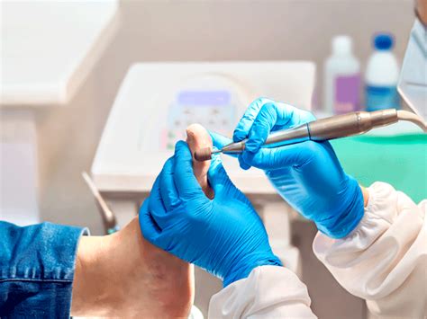 Eccema Dishidrótico En Los Pies Síntomas Causas Y Tratamientos