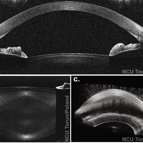 4 D OCT Imaging Of Eye Dynamics Movies Showing Volumetric Download Scientific Diagram