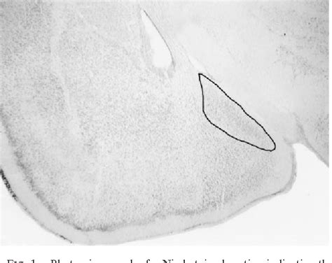Figure 1 From A Brain Sexual Dimorphism Controlled By Adult Circulating