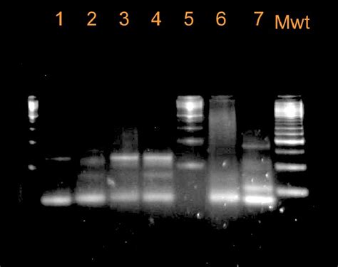 Amplified Pcr Products Of Dengue Virus Serotypes 125bp Denv 2 Download Scientific Diagram