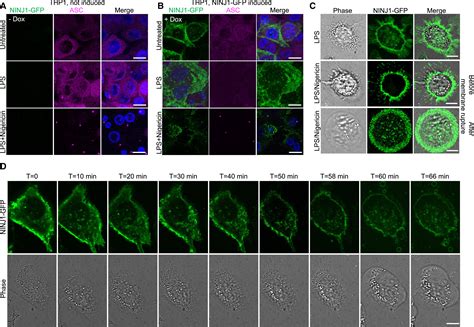 Ninj1 Mediates Plasma Membrane Rupture By Cutting And Releasing Membrane Disks Cell