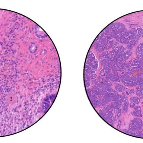 Characteristics Of Histological Response Download Scientific Diagram