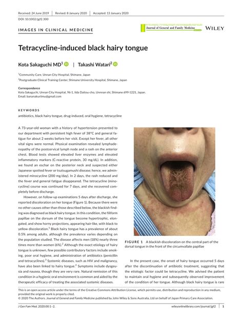 Pdf Tetracycline‐induced Black Hairy Tongue