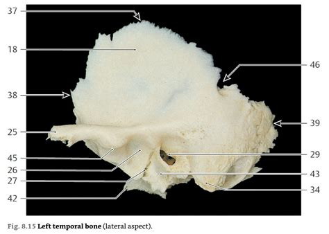 Temporal Bone Left Lateral Diagram Quizlet