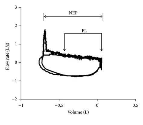 Maximal And Tidal Flow Volume Curve In Two Representative Copd