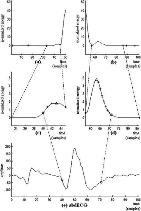 Maternal Fiducial Point Detection A Et For The Sub Window T I − Download Scientific