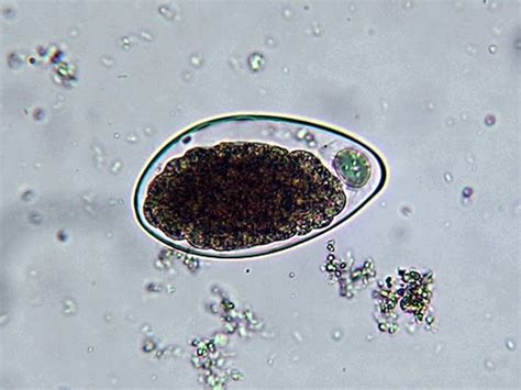 Fun With Microbiology Whats Buggin You Hookworm