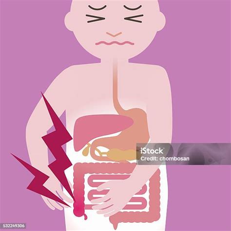 Appendicite Et Digestif Humain Organes Simplifié Illustration Vecteurs