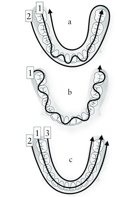 A Scanning Procedure With A Wiggling Motion In The Incisal Region B