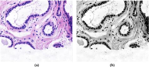 Image Enhancement Using Contrast Limited Adaptive Histogram Download Scientific Diagram
