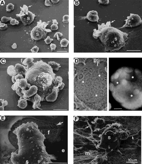Hiv Induced T Cell Syncytia Have Been Found To Extend A Giant