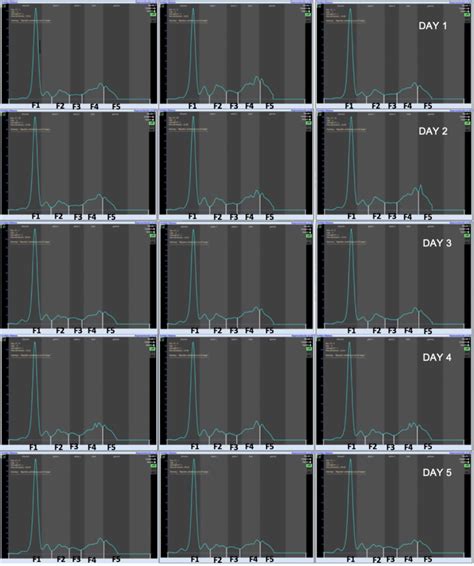 Reproducibility And Repeatability Experiment Using A Urine From A Download Scientific Diagram