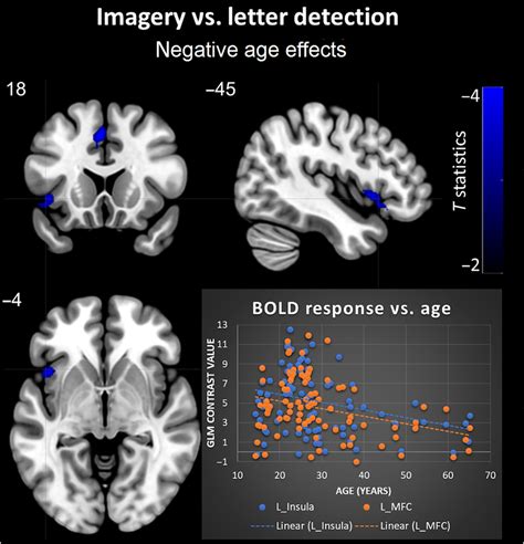 Age Influence On Main Effect Task Brain Clusters With Fmri Response To