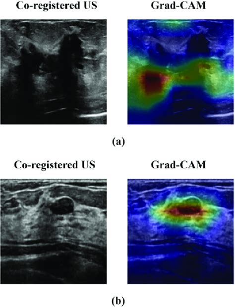 Heat Maps Calculated Using Grad Cam For The Final Convolutional Layer Download Scientific