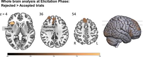 Exploratory Whole Brain Analyses At Elicitation Phase Showed