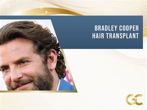 Bradley Cooper Hair Transplant Acıbadem Best Hair Transplant Turkey