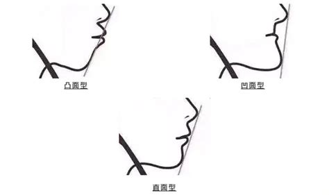 合肥牙齿矫正：正畸医生眼中的侧貌美——什么样的侧颜算是好看？ 知乎