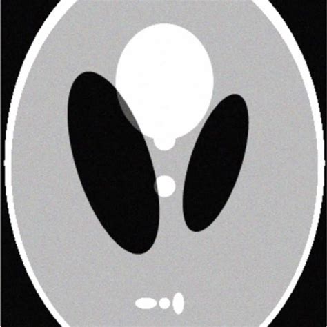 The Shepp Logan Phantom Image Download Scientific Diagram