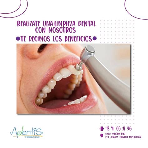 Adentis Dentista Realizarse Una Limpieza Dental De Forma Periódica Es