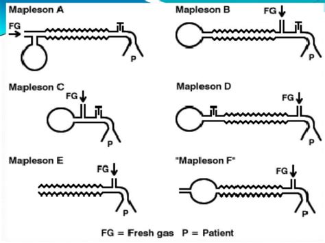 Breathing Circuit Pptx