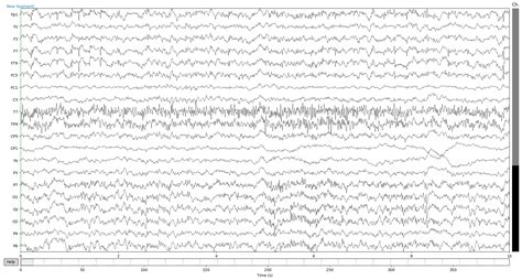 Basic Eeg Processing With Mne Ayan S Blog