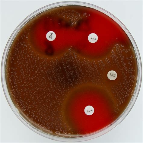Streptococcus Agalactiae DrBeckmann