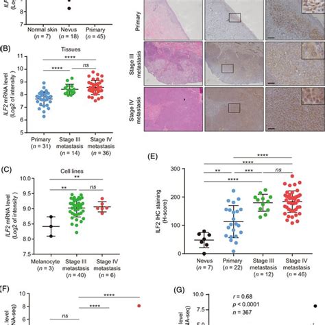 Ilf2 Controls Dna Damage Response In Metastatic Melanoma Cell Lines A