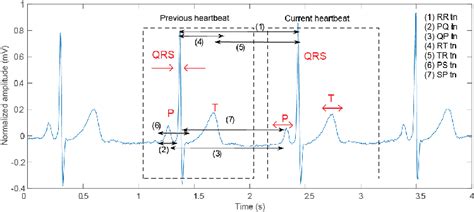 An Annotated ECG Waveform Highlighting ECG Wave Components And The Download Scientific Diagram
