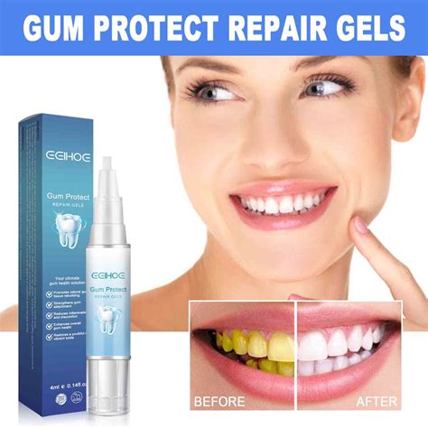 Teeth Whitening Pen No Sensitivity Teeth Whitening Gel Effective