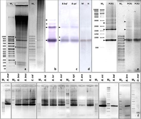A Reversed Image Of The Agarose Gel Electrophoresis Of A Genomic Dna