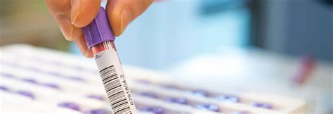 Full Blood Count Fbc London Doctors Clinic