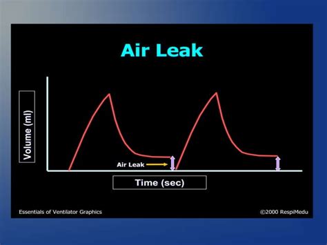 Ventilator Waveforms Dr Sanjay Chugh Pptx