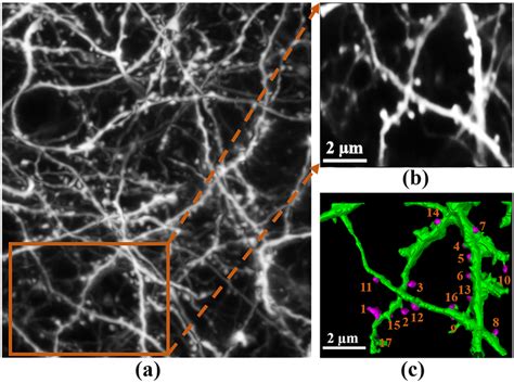 3d Reconstruction Of The Segmented Spines From An In Vivo Sample Image Download Scientific