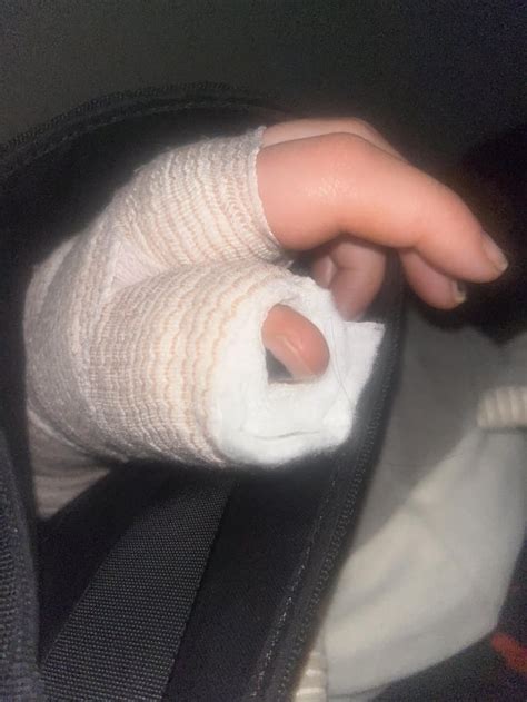 Nerve Block Wrist Surgery R Surgerytalks