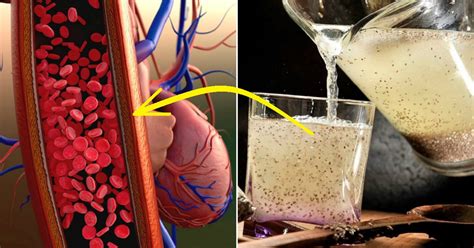 არომატული ნაყენი სამჯერ დღეში ჰიპერტონიკების სასწრაფო დახმარება Popsugar