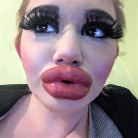 Huge Lips Big Lips Trend Big Top Lip Lips Woman