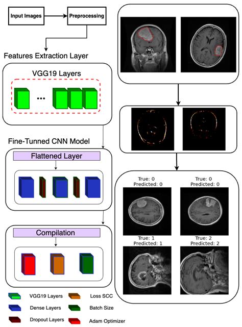 a unified pipeline for simultaneous brain tumor classification and