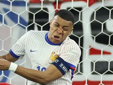Tất Tần Tật Tình Huống Mbappe Gãy Mũi