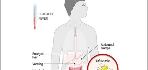 Salmonella Causes Salmonellosis Healthy Food Near Me