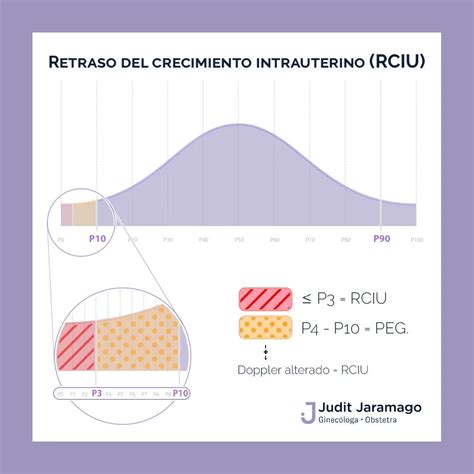 Restricción Del Crecimiento Intrauterino Rciu Doctor Online