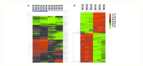 Differential Expressions Of Lncrnas In Both Pbmcs And Plasma From Cad