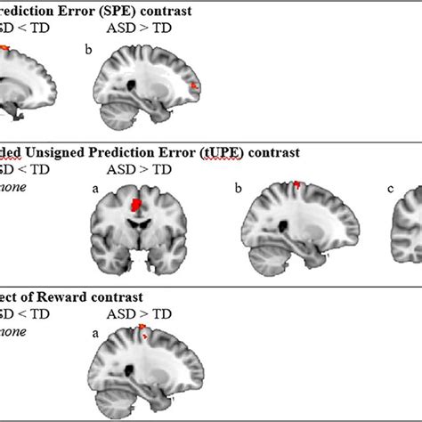 Regions Of Activation For The Social Task Clusters That Revealed Group