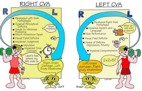 Right CVA Left CVA Stroke Nursing Nursing School Survival Nursing
