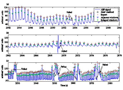 A Novel Approach To Detecting Pulse Onset In Photoplethysmographic