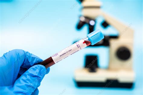 Reverse T3 Test Stock Image F0449758 Science Photo Library