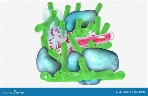 Fluid Accumulation In Lymphatic Tissue Stock Illustration Illustration Of Anatomy Wood 281920570