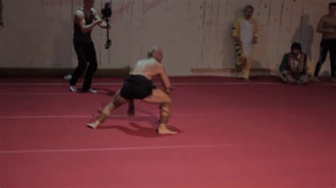 Bone Sticking Out Of Foot Youtube