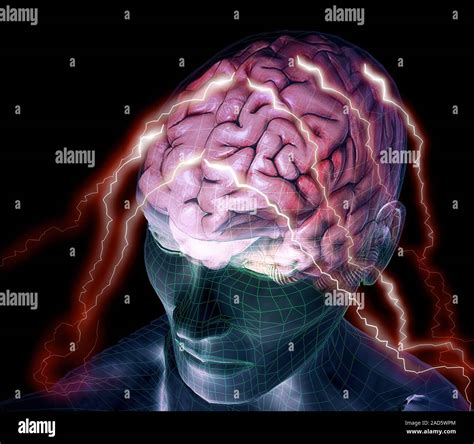 Migraine Conceptual Image Of A 3d Brain Magnetic Resonance Imaging Mri Scan With Flashes Of