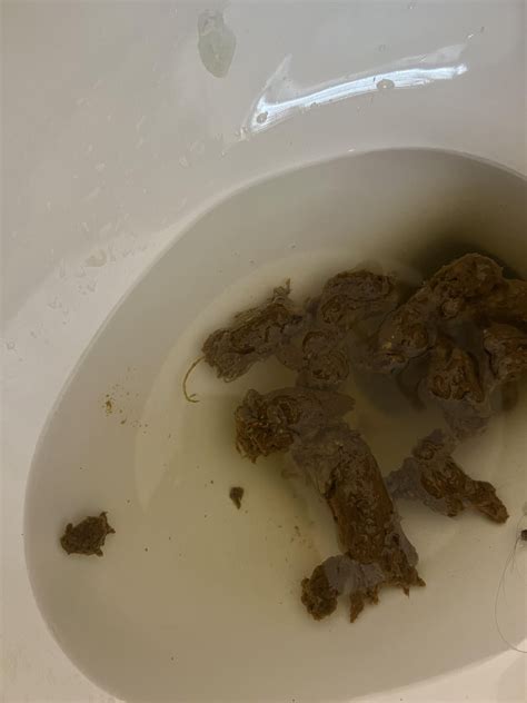 Worms In Stool Rpoop