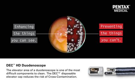 Pentax Medical Canada On Linkedin Endoscopy Ercp Scope